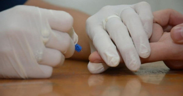 Test gratuitos de VIH en Salud Estudiantil - Bienestar Universitario